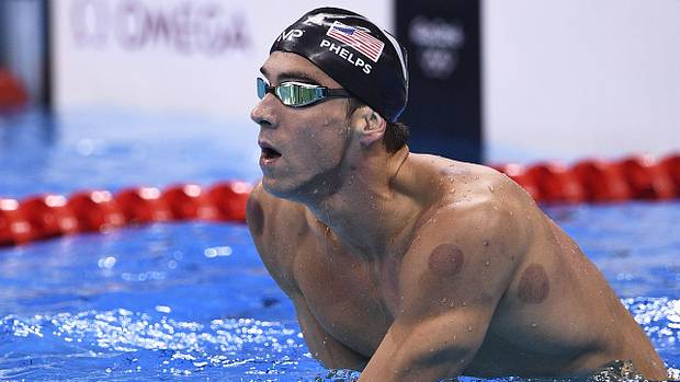 Rio 2016: Michael Phelps cupping therapy benefits - Sports Illustrated