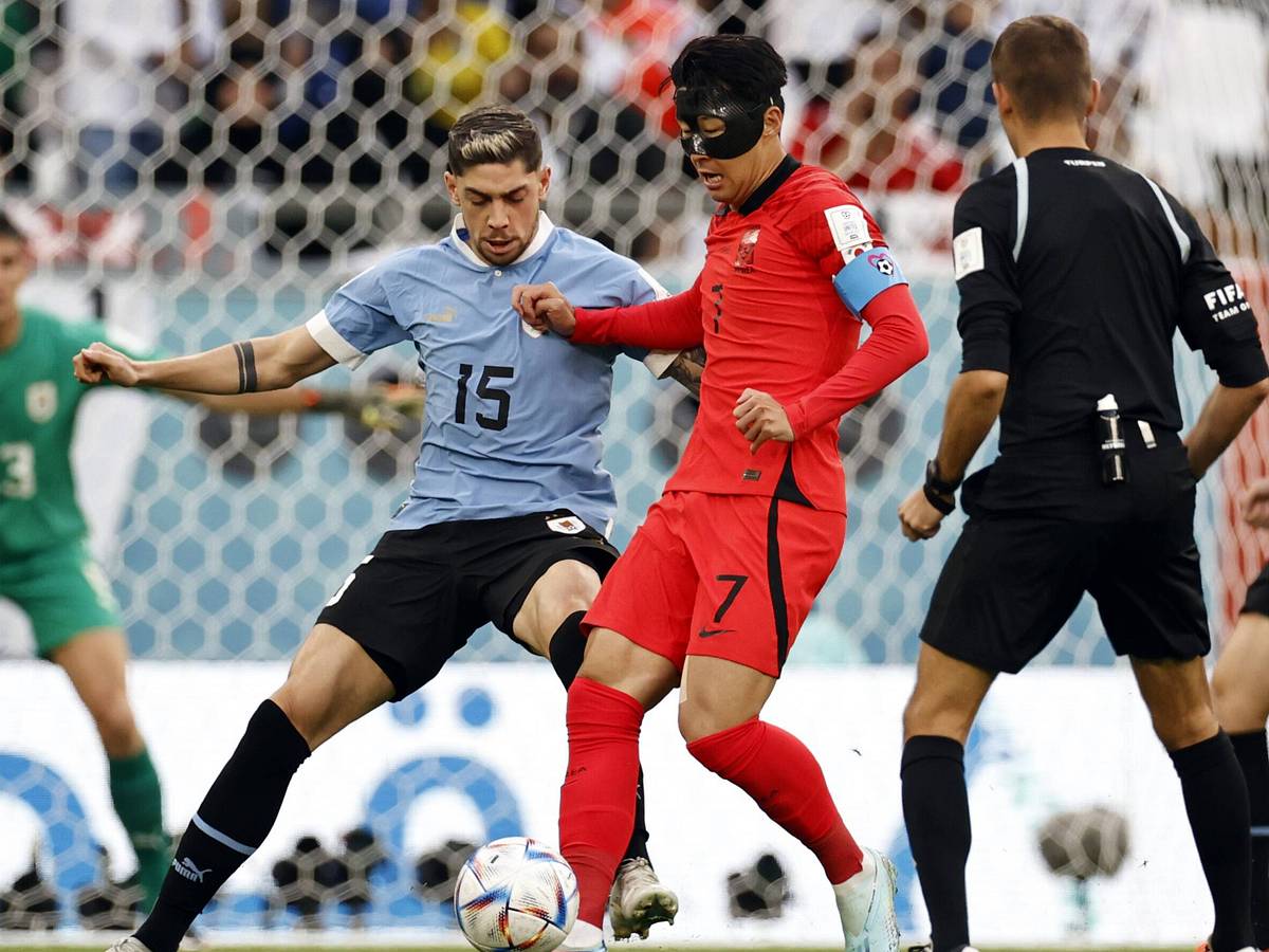 Soccer Compound Fractures