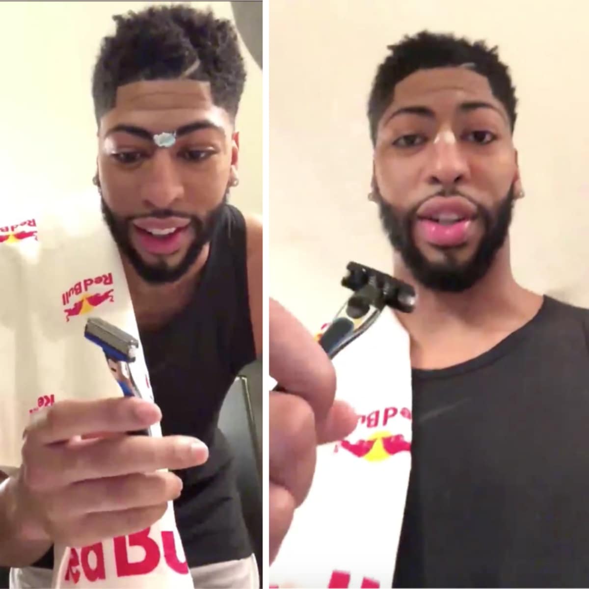 anthony davis eyebrows