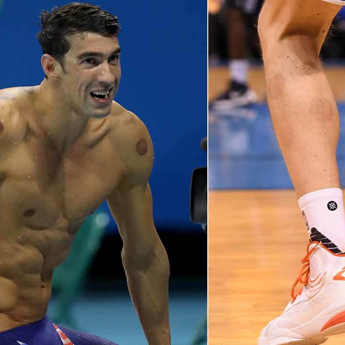 michael phelps back marks