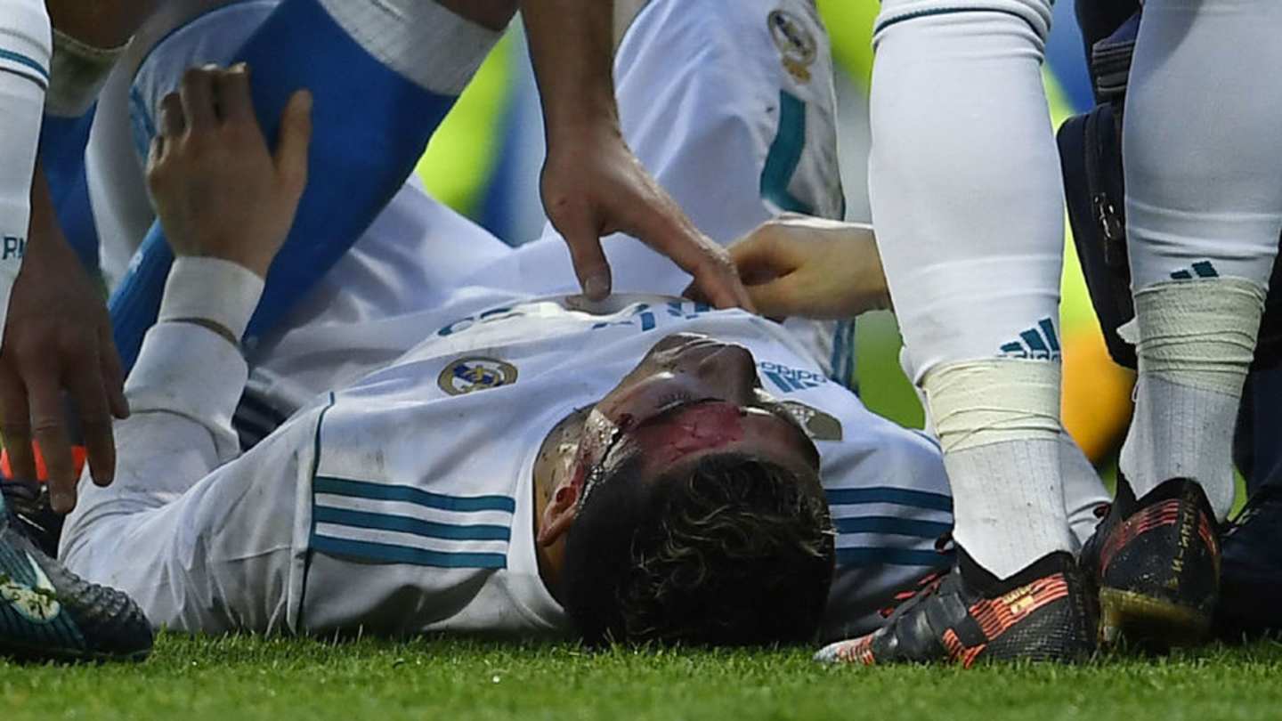 Cristiano Ronaldo: Head injury needed stitches; won't be out long ...