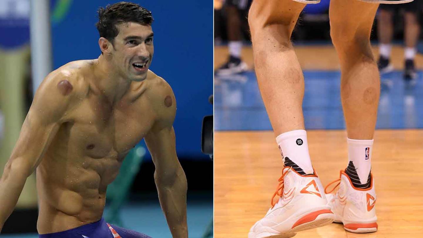 Michael Phelps, NBA players using cupping for recovery - Sports Illustrated