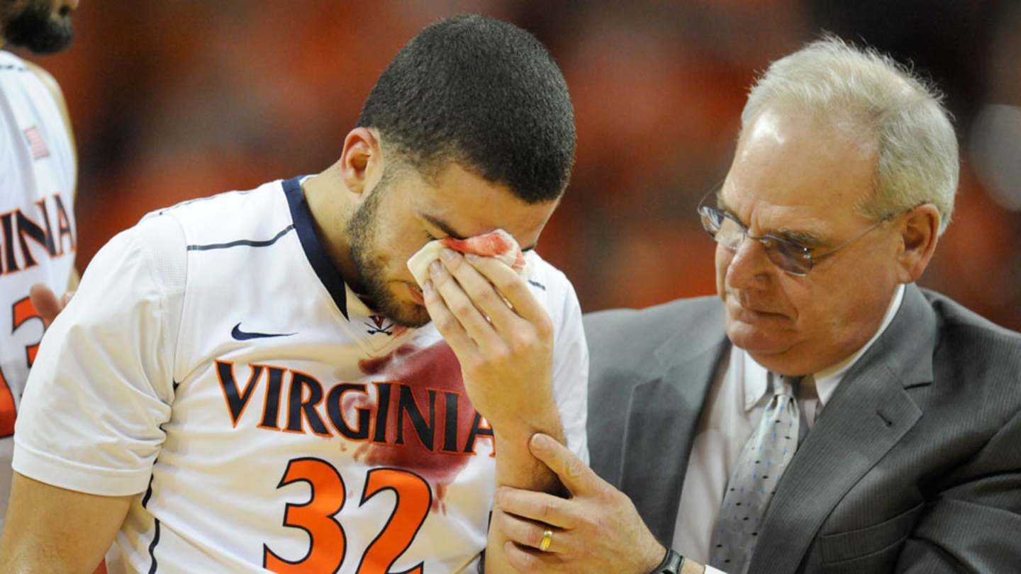 Virginia PG has London Perrantes broken nose, mild concussion - Sports ...