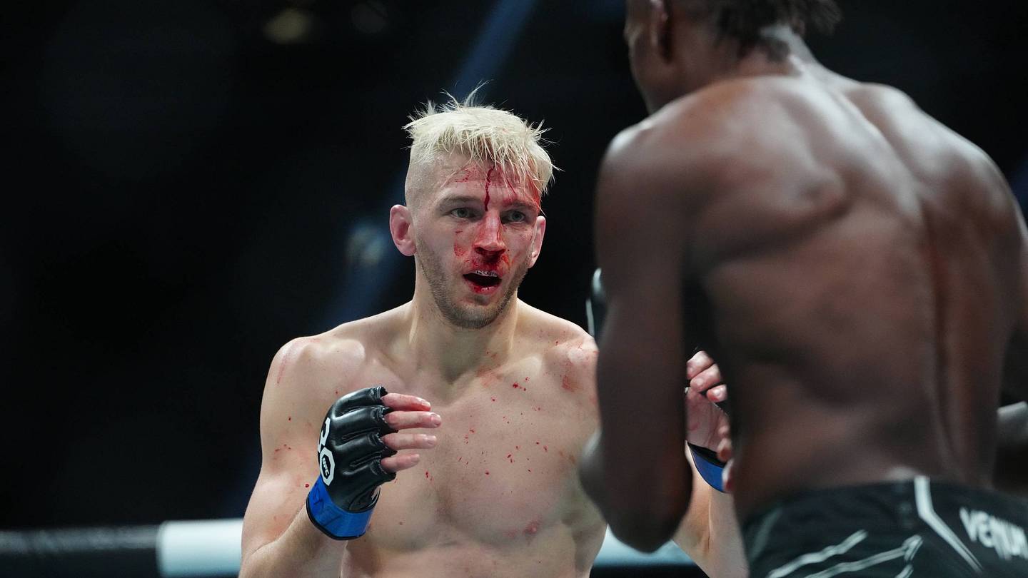 Dan Hooker Posts X-ray of Broken Arm After UFC 290 Victory - Sports ...