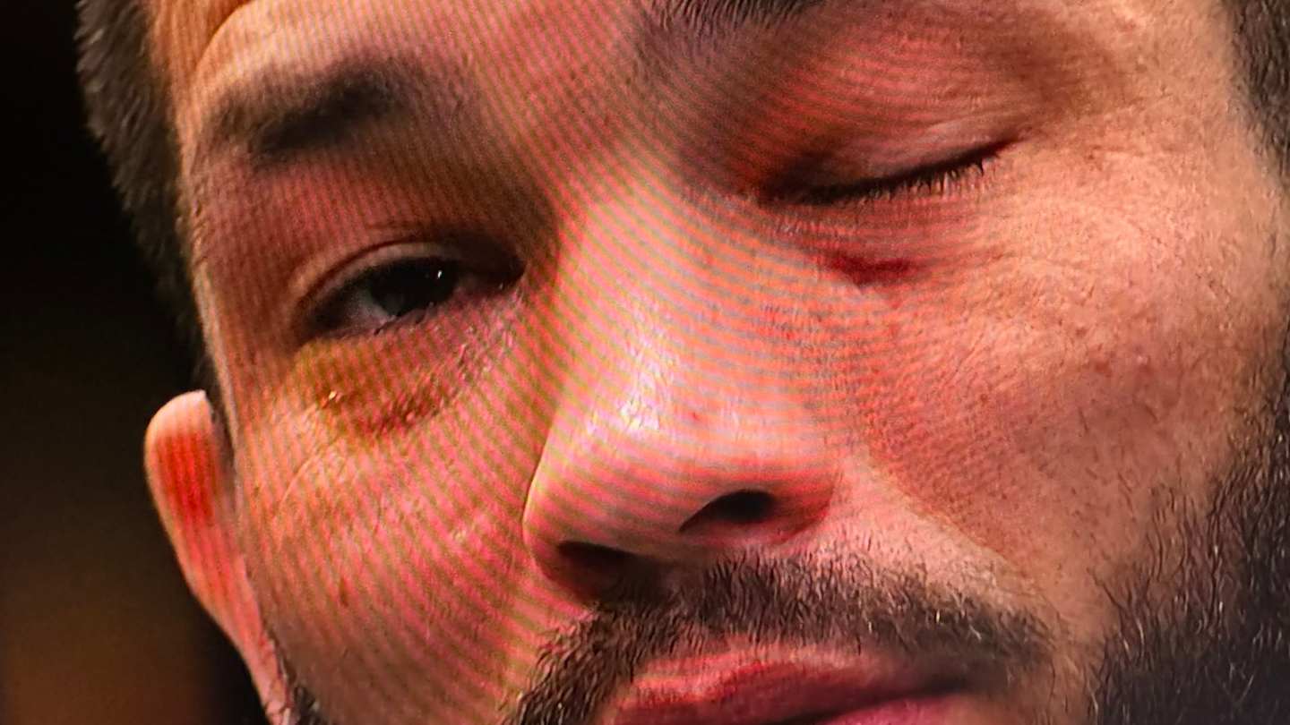 Ex-UFC Champ Calls for Major Change After Eye Poke Travesty at UFC ...