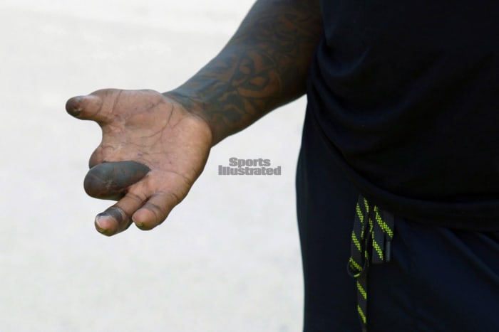 Jason Pierre-Paul details firework explosion, hand injury - Sports ...