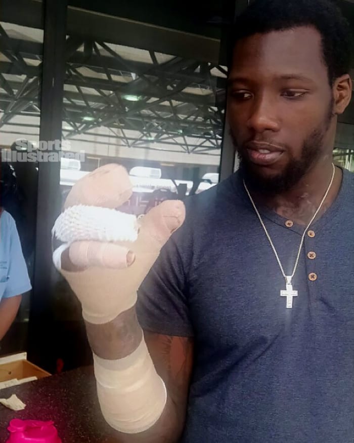 Jason Pierre-Paul details firework explosion, hand injury - Sports ...