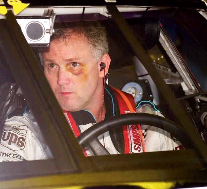 Black Eyes in Sports - Sports Illustrated