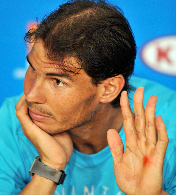 Rafael Nadal treated for nasty blister on hand at Australian Open ...