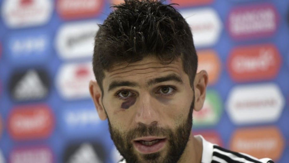 GENIAL | La broma de Federico Fazio por el moretón en su cara - Sports ...