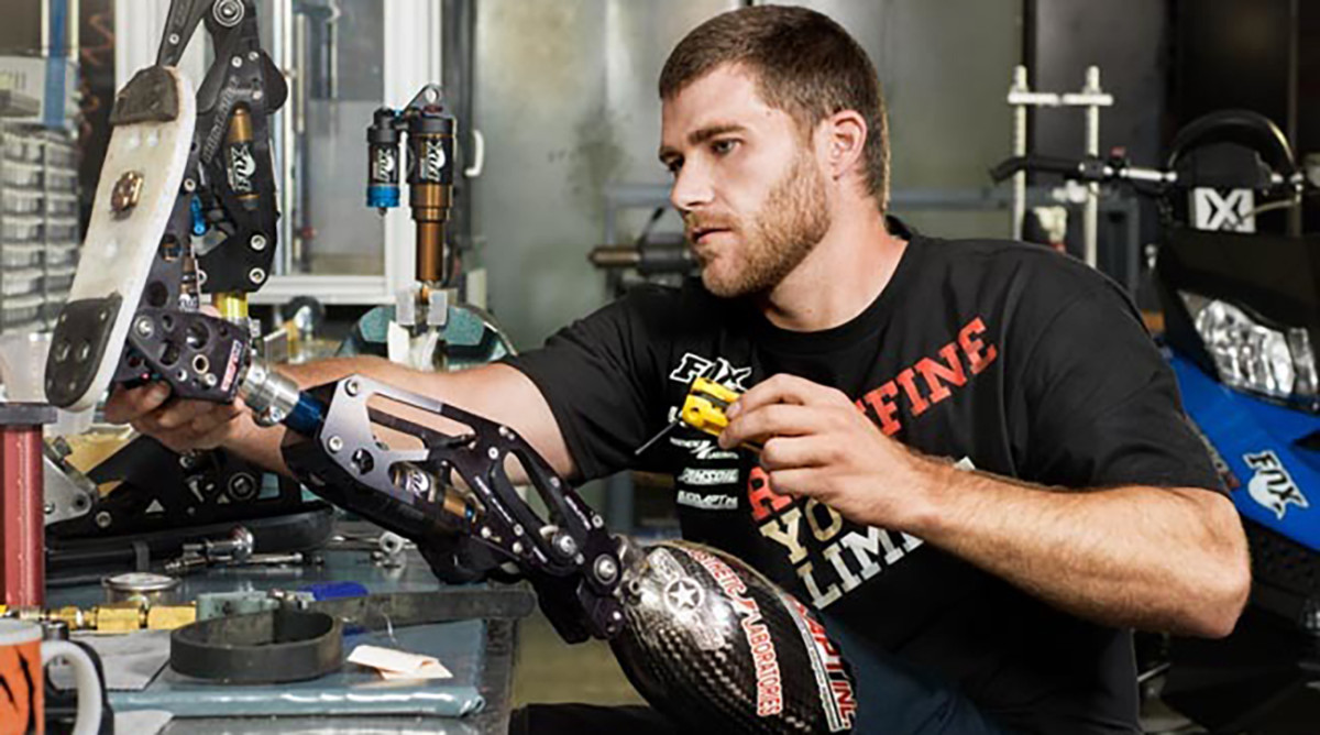 2018 Winter Olympics: Mike Schultz talks leg amputation - Sports ...