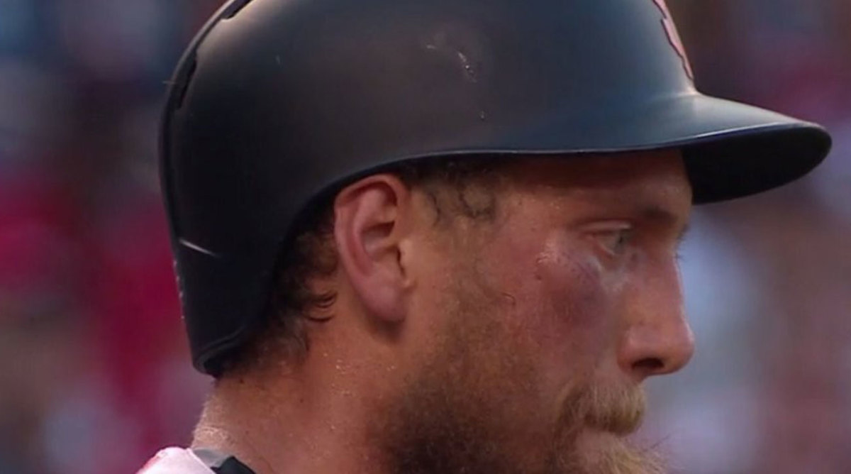 Hunter Pence: Giants OF fouls baseball off his face - Sports Illustrated