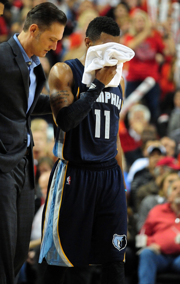 Memphis G Mike Conley has facial surgery - Sports Illustrated