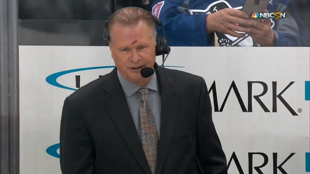 Brian Engblom hit with puck during game broadcast, get stitches ...