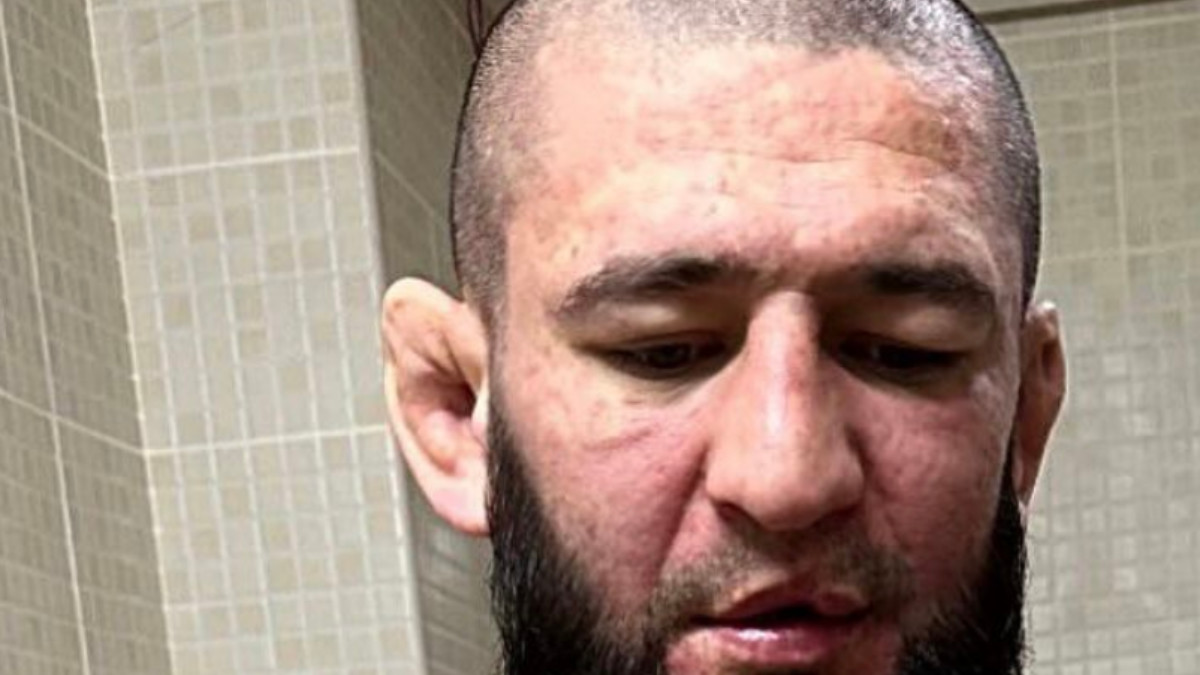 UFC: Khamzat Chimaev Shares Shocking Illness Photos Before Kamaru Usman ...